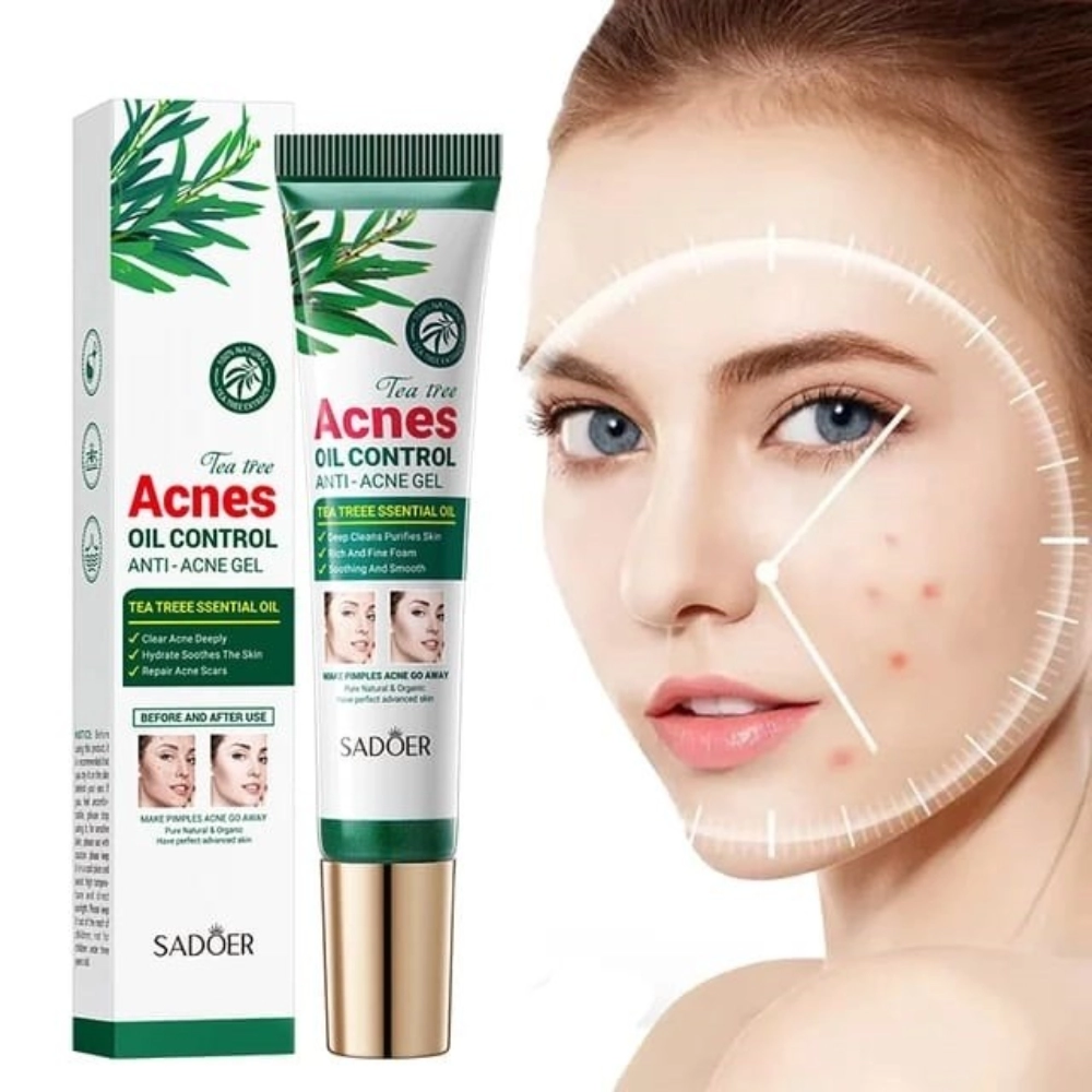 SADOER Tea Tree Acne Oil Control Face Gel Anti-Acne Hydrating ...