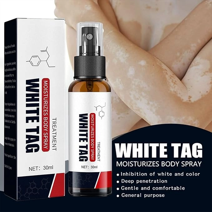 White Tag Spray For Vitiligo, Psoriasis, Leukoplakia - Reduces White ...