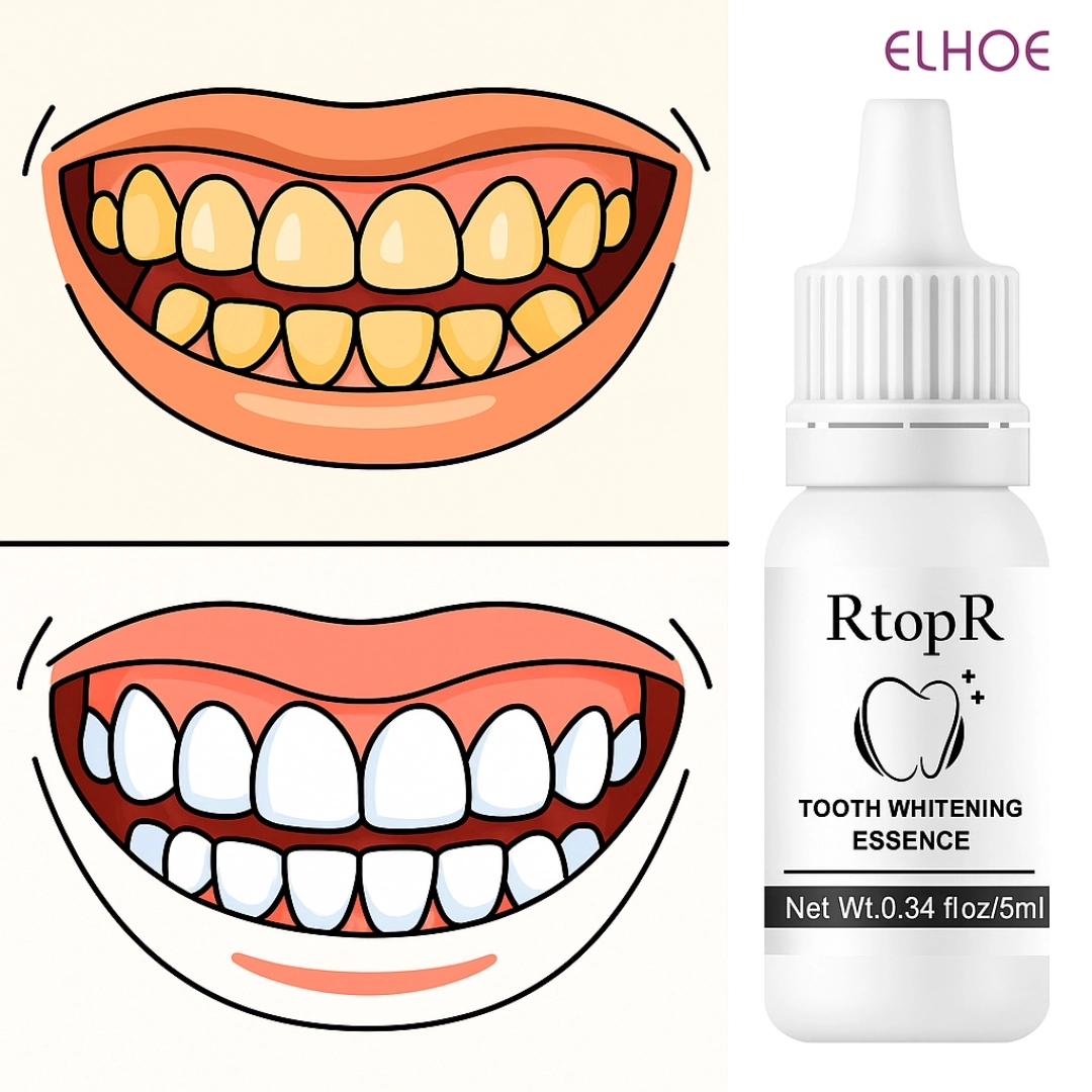 ELHOE RtopR Teeth Whitening Essence: Best for Stains & Discoloration ...