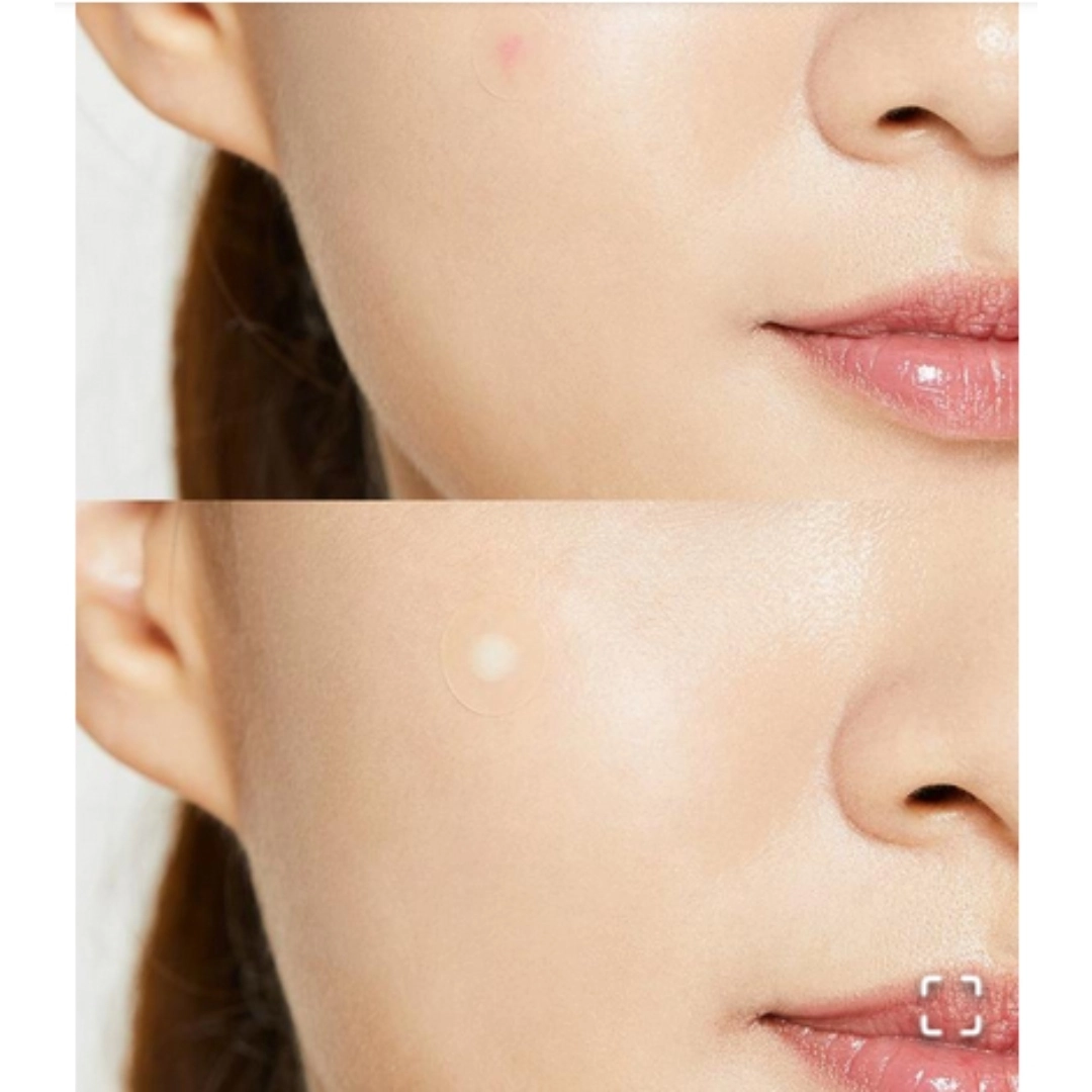 Cosrx Acne Pimple Master Patch 24 patches